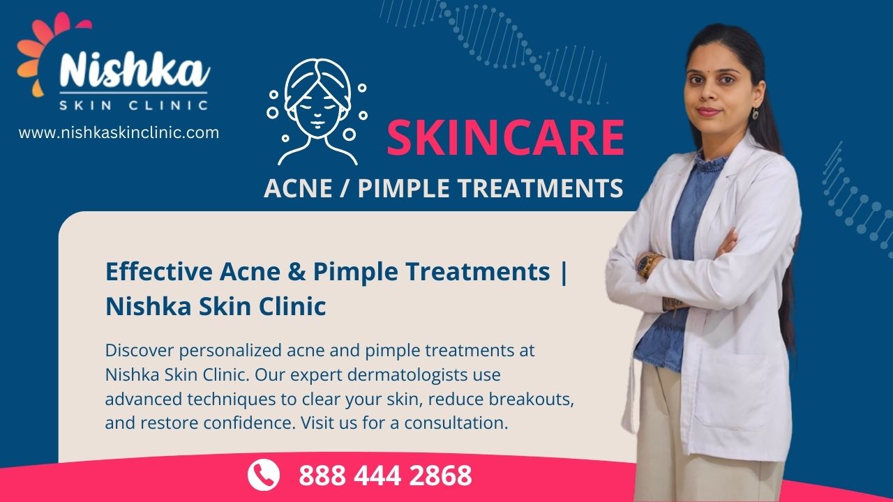 Effective Acne & Pimple Treatments | Nishka Skin Clinic